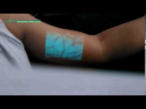 Vein Finder VS300 used on arms