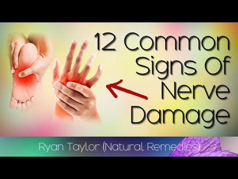 12 Signs Of Nerve Damage (Neuropathy)