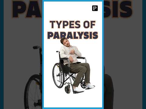 5 Types of Paralysis