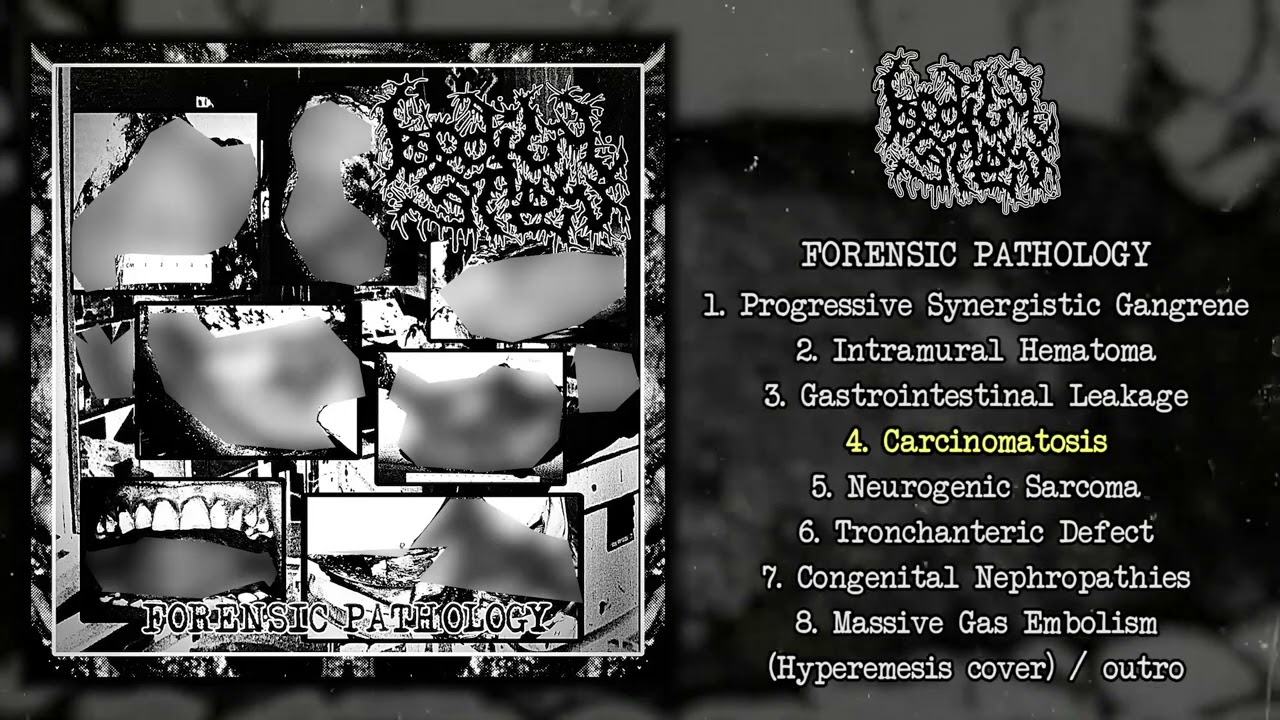 Bodily Stew - Forensic Pathology FULL EP (2022 - Goregrind)