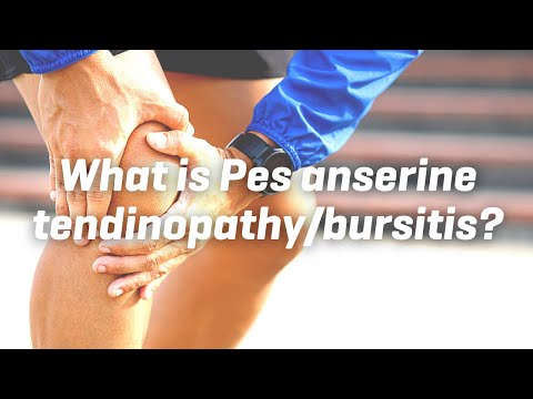 What is Pes anserine tendinopathy/bursitis?