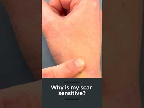 Scar Sensitivity Explained: Why Massage Matters