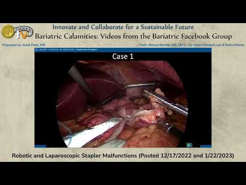 Robotic and Laparoscopic Stapler Malfunctions (Posted 12/17/2022 and 1/22/2023)
