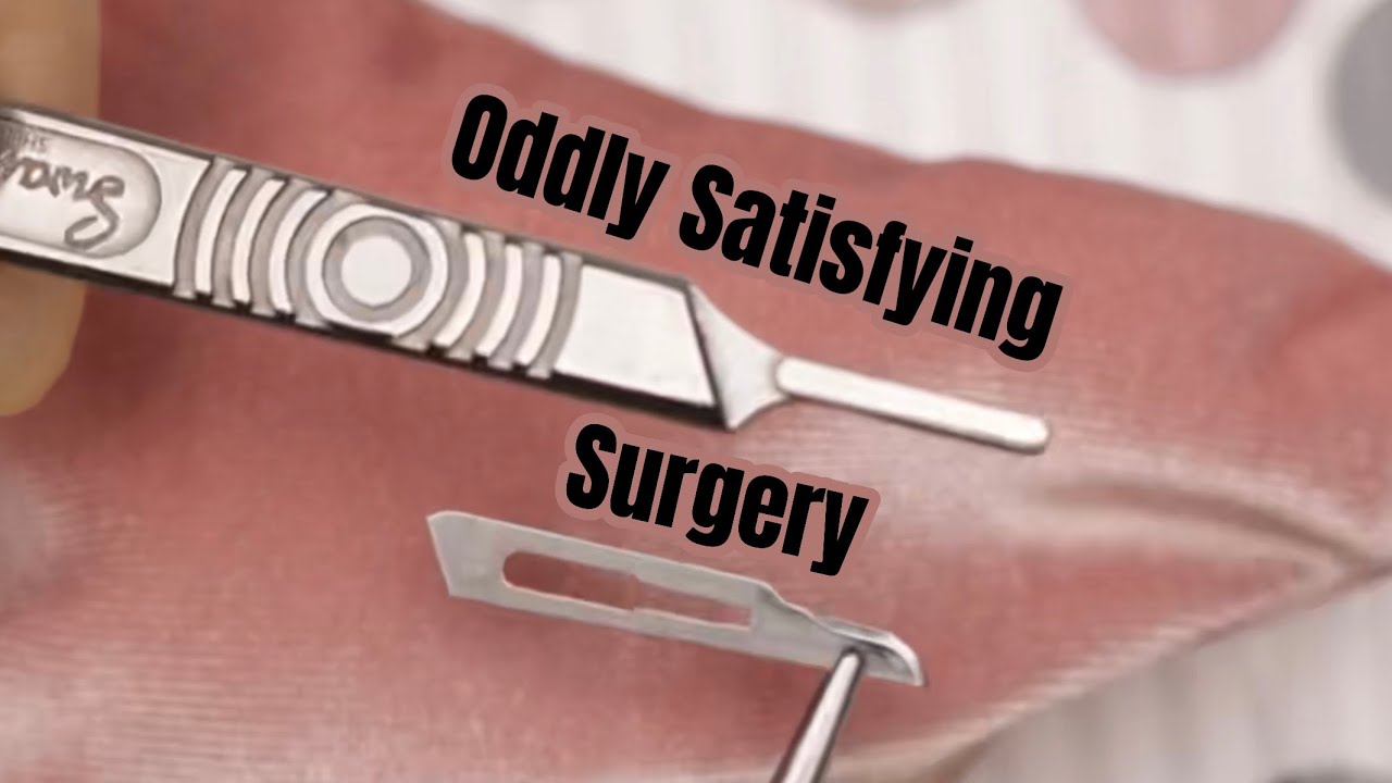 Must See: Cauliflower Ear Prevention Surgery