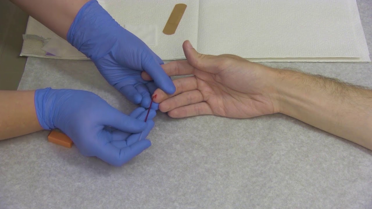 Puncture Pipette full