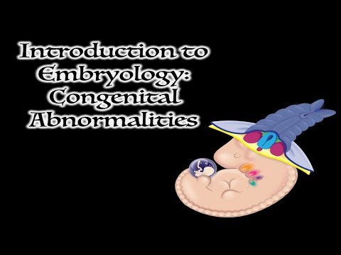 Congenital Abnormalities