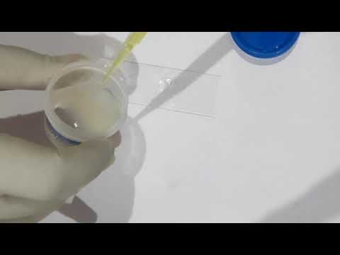 Semen Analysis in Hindi | Semen Test | Semen Test Report | Sperm Count |पुरूष वीर्य जांच| LABOeXPERT