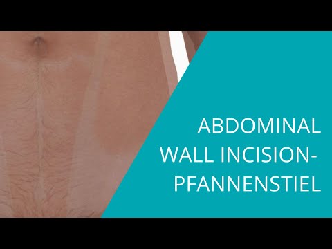 Abdominal Wall Incision - Pfannenstiel - How to approach the abdominal cavity