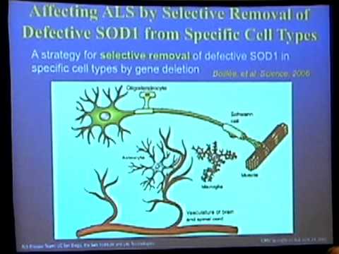 Lou Gehrig's Disease (ALS): UCSD Team's Stem Cell Therapy Rationale