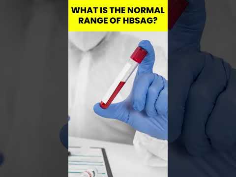 What is the normal range of HBsAg | HBsAg #short #shorts #shortvideo