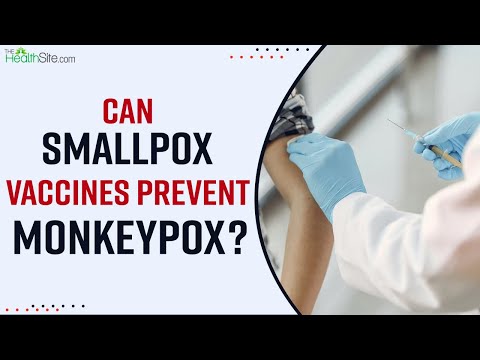 Monkeypox Outbreak: Smallpox Vaccine Is A Treatment For Monkeypox?