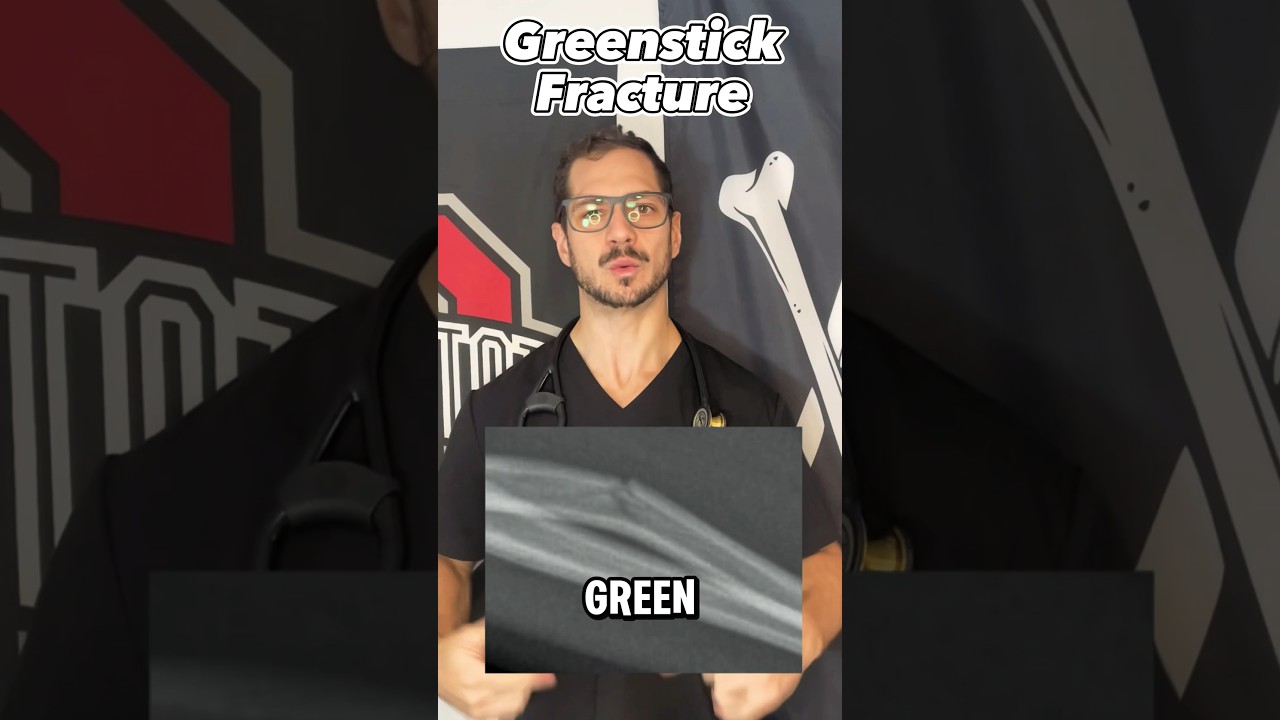 What Is A Greenstick Fracture? #shorts #fracture #medical