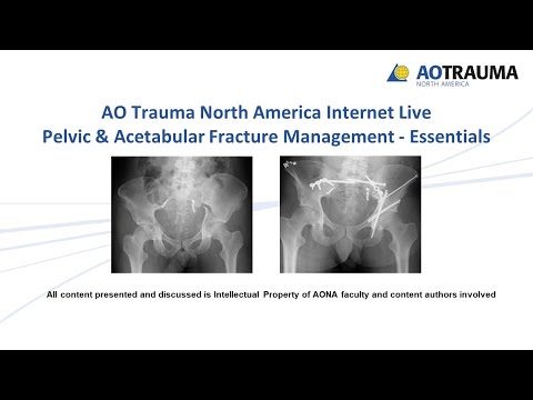 Pelvic & Acetabular Fracture Management Essentials Homework Week 1: Ilioinguinal Approach-Letournal