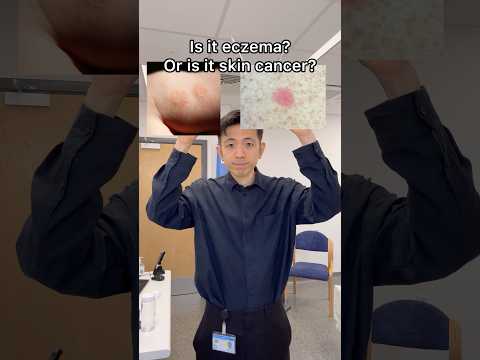 Dermatologist explains - is it eczema or is it skin cancer? #skincancer #eczema #dermatologist