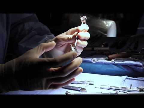 Anterior Cervical Discectomy - Bryan Cervical Disk