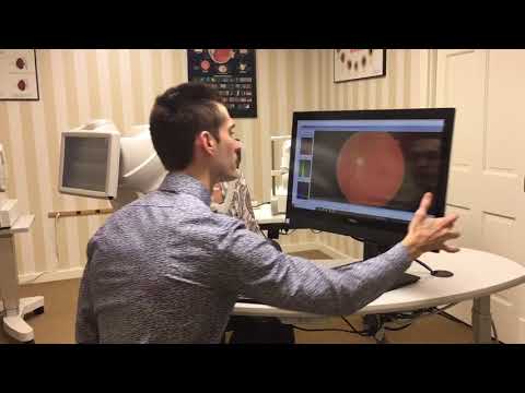 Digital Retinal Scan