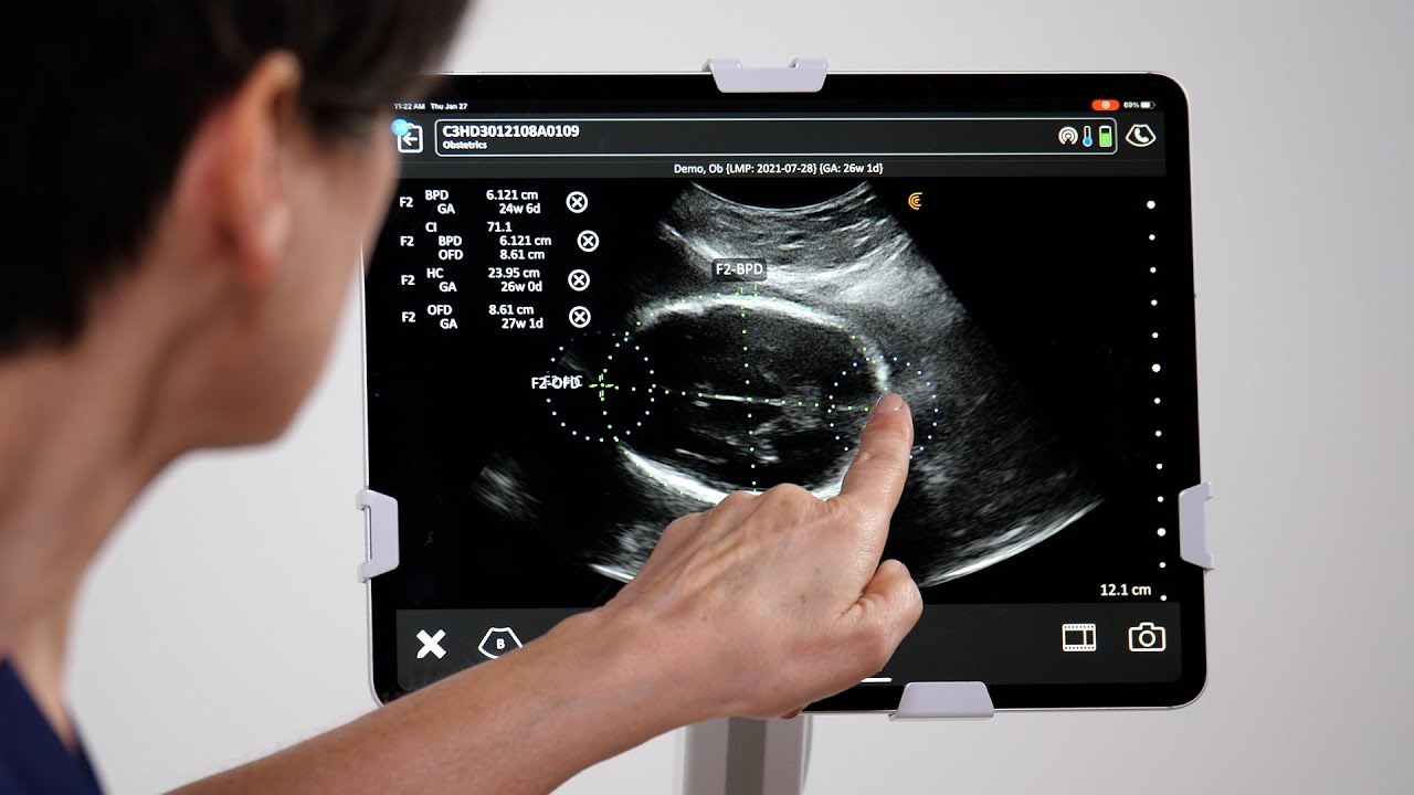Fetal Head Measurements