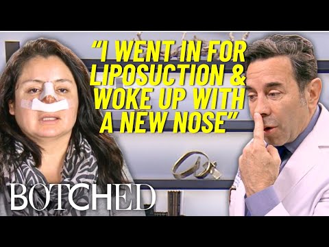 Mariela Was Given A Nose Job WITHOUT Her Consent | Botched | E!