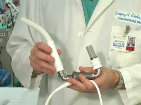 Left Ventricular Assist Device - LVAD Procedure