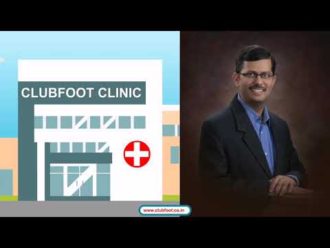 clubfoot treatment using Ponseti method explained by Dr Sameer Desai