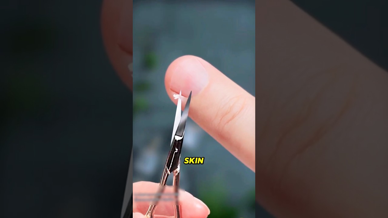 Never Pull Off Peeling Skin Around Your Nails!