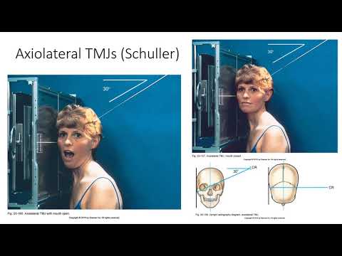 Radiographic Positioning of the TMJs