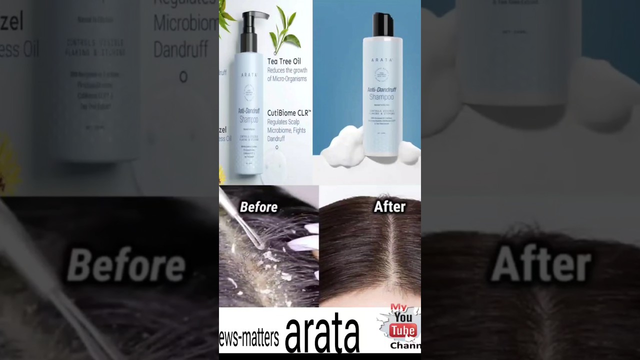 Arata dandruff shampoo review after self use #haircare #arata #natural