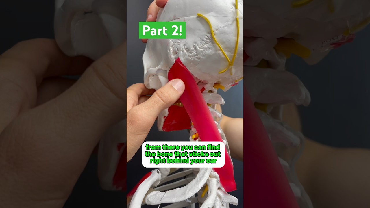 Part 2! Splenius Capitis Release #headaches #headachessuck