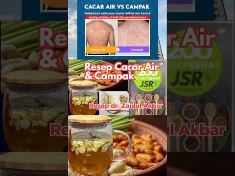 Resep untuk Mengobati Cacar Air dan Campak menurut dr.Zaidul Akbar #jsr #zaidulakbar #herbal