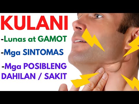 Lunas at GAMOT sa KULANI sa LEEG, Kili kili, Singit + Mga dahilan ng Namamaga Masakit na KULANI