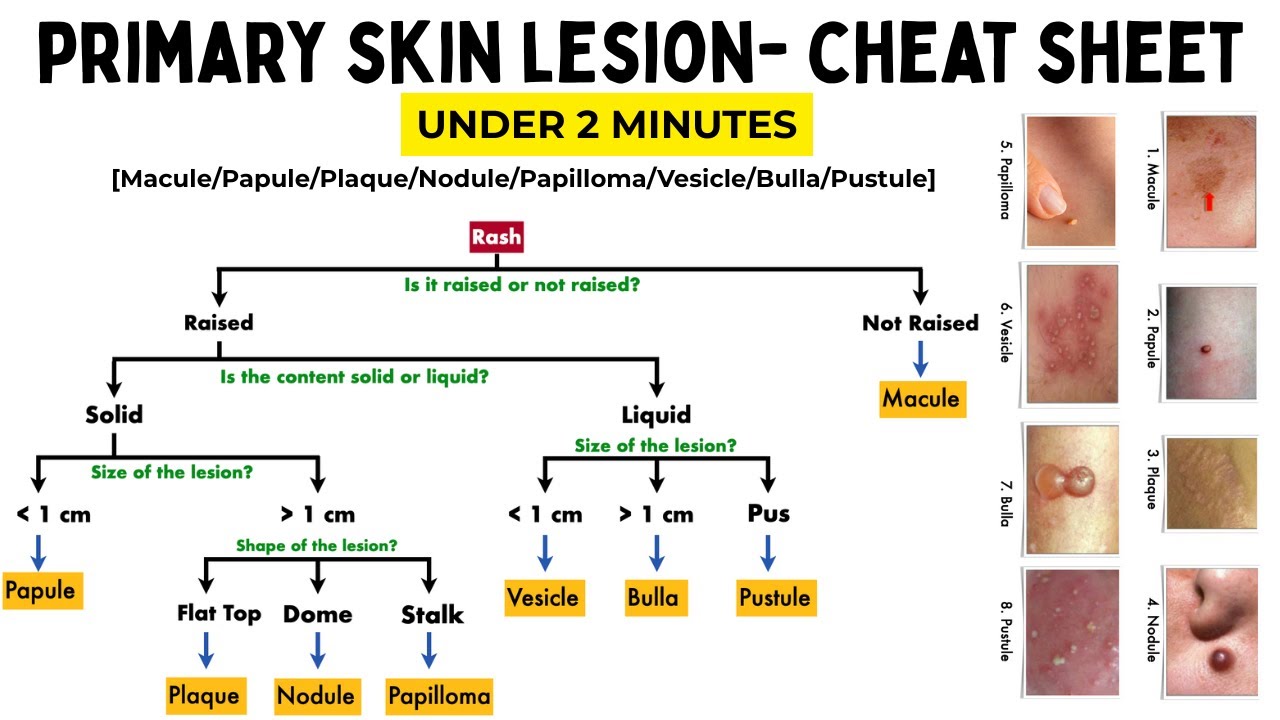 Primary Skin Lesions In 2 Minutes | Dermatology Cheat-Sheet | Macule, Papule & Others | MBBS, MD, DM