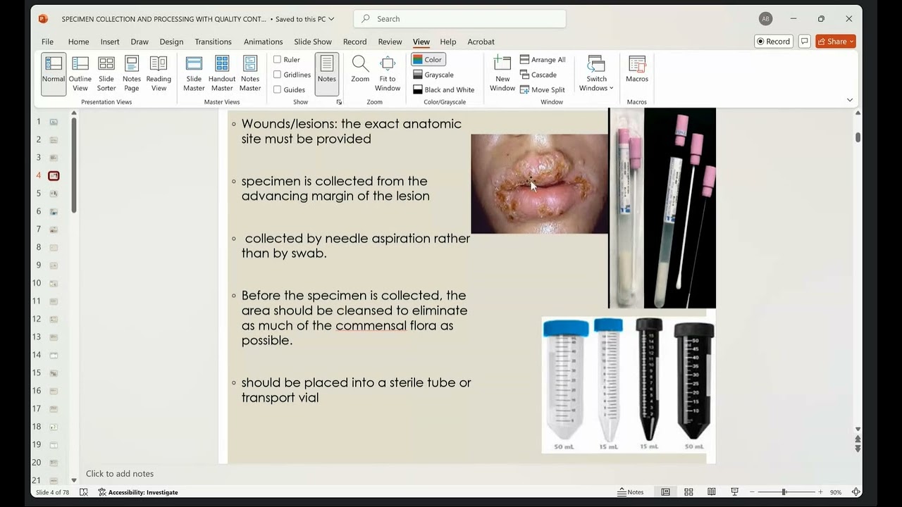 BACTE  - SPECIMEN COLLECTION AND PROCESSING