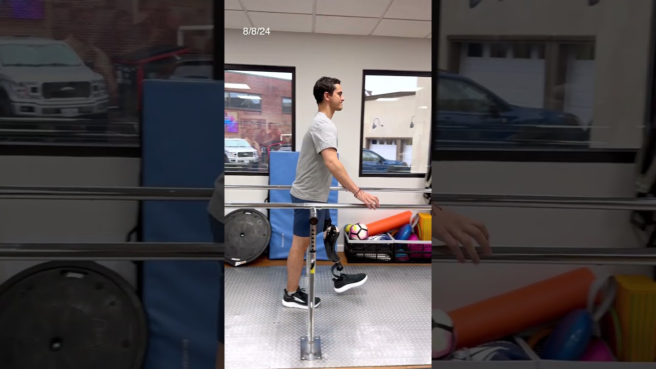 JP’s Recovery Journey: After Rotationplasty Amputation