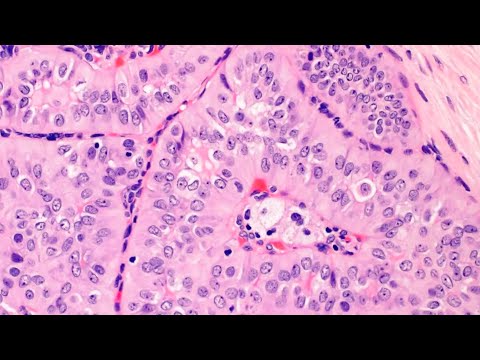 What Every Pathologist Should Understand About Breast Imaging