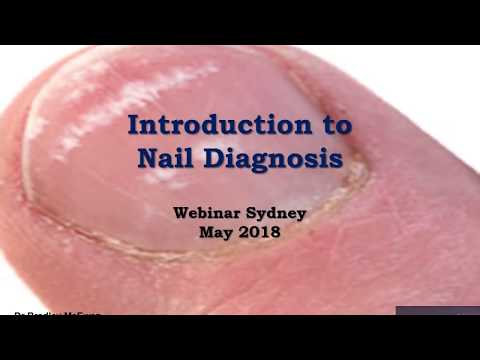 Introduction to Nail Diagnosis – Vitamedicine