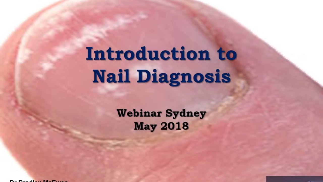 Introduction to Nail Diagnosis - Bradley McEwen May 2018