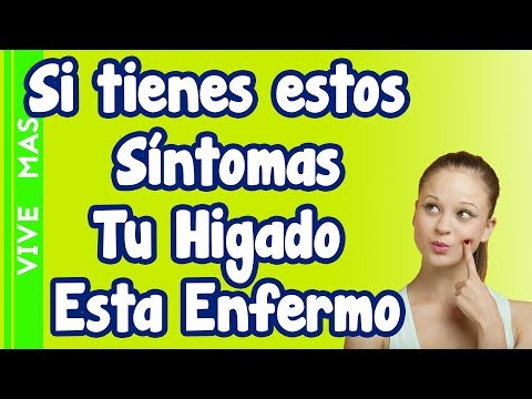 Estos son los Síntomas de un Hígado Enfermo e intoxicado que debes ...