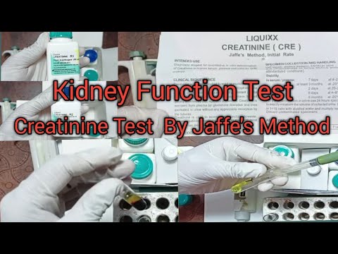 Creatinine test procedure || Kidney Function Test .