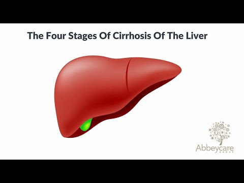 What Are The Four Stages of Cirrhosis Of The Liver?