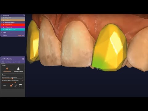 🔮 Crystal Teeth Library - Software・ 3D File for 3D printing・Cults