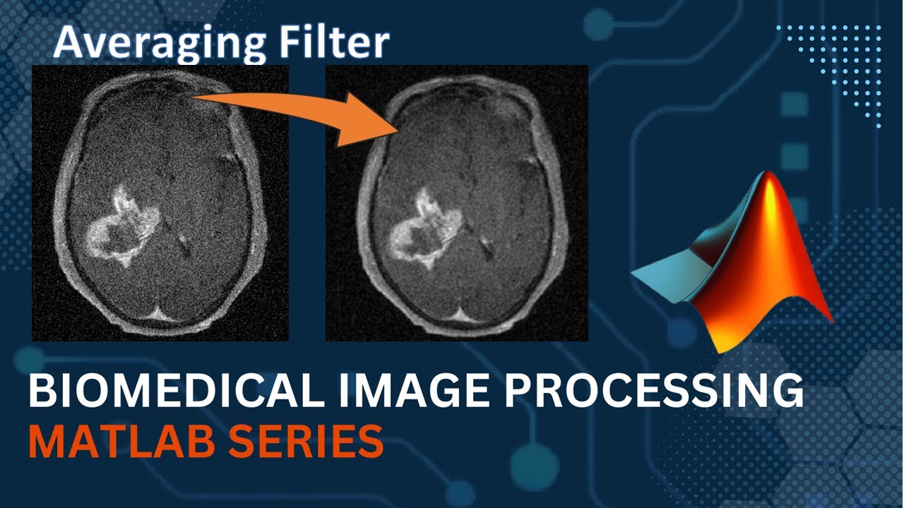 Averaging Filter || MATLAB Code Implementation || Medical Image Processing | Computer Vision
