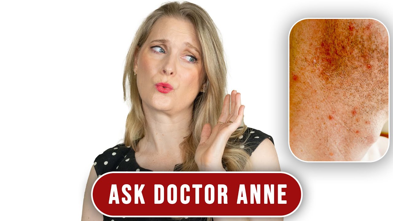 Stop ingrown hairs - the best ways for prevention and treatment | Ask Doctor Anne