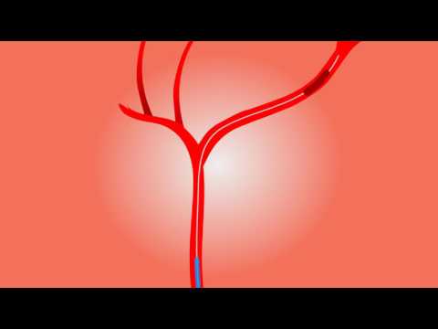 How the Body Works - Human Brain 2