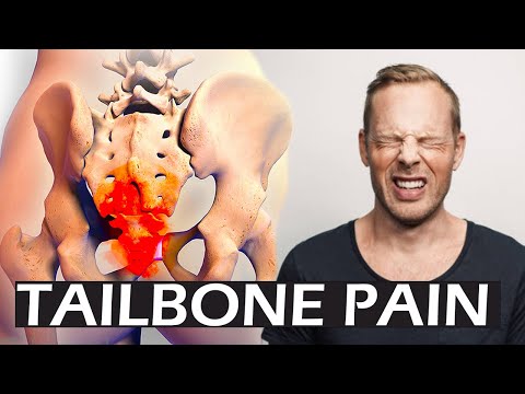 Coccydynia - Tailbone pain - coccygeal pain