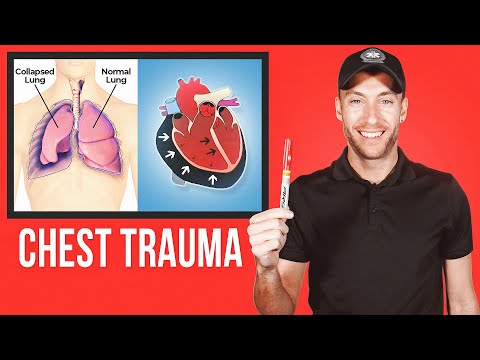 EASY Guide for CHEST TRAUMA