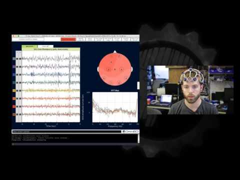 Strange synchronous ECG and EEG artifact — OpenBCI Forum