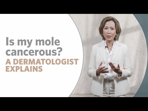 Is my mole cancerous? | Angeline Yong Dermatology