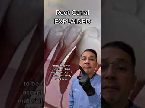 Root Canal Treatment EXPLAINED By Dentist | View Mobile Dental