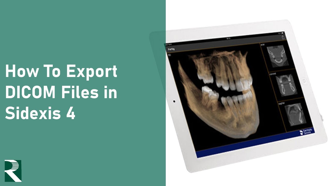 Sidexis 4 - How to export DICOM files