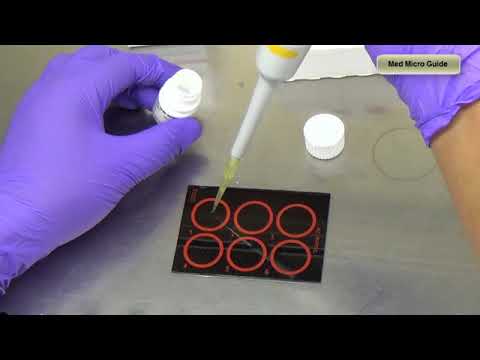Antistreptolysin O (ASO) test lecture